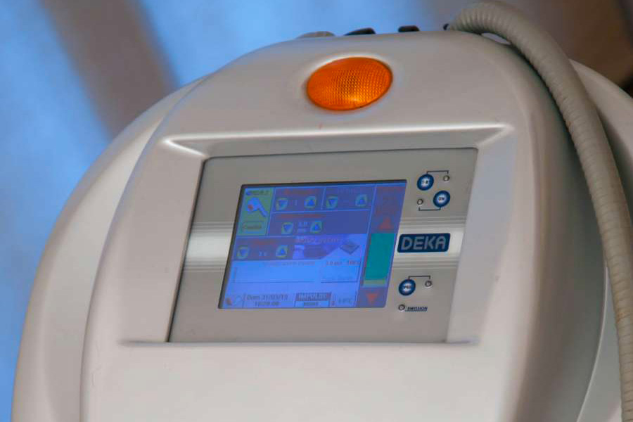 Epilazione con luce pulsata - CG Beauty Center